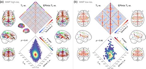 Structural Covariance Networks Constructed From Epimix And Download Scientific Diagram