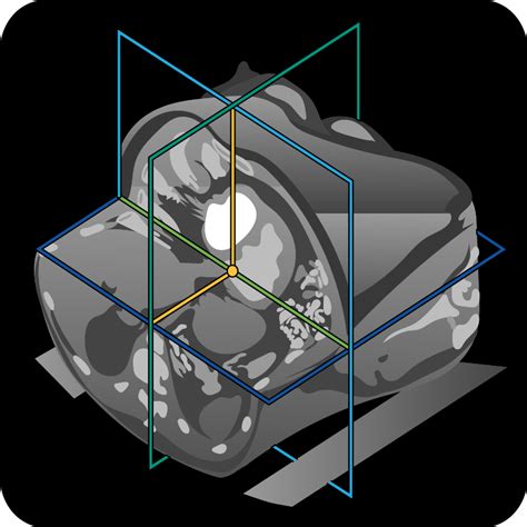 Phlebostatic Axis Point Figure Science Figures