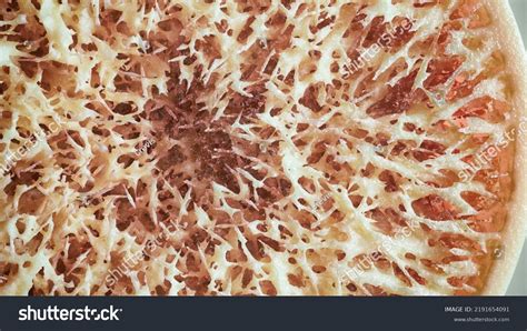 Osteoporosis Cross Section Bone 3d Rendering Stock Illustration 2191654091 Shutterstock