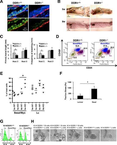 Figure 1 From Discoidin Domain Receptor 1 Ddr1 Ablation Promotes