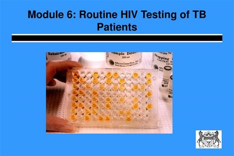 Ppt Module 6 Routine Hiv Testing Of Tb Patients Powerpoint