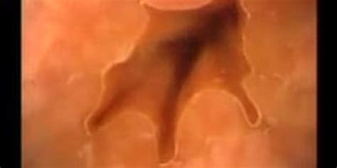 Japanese Rectal Exam Video Tnaflix Com