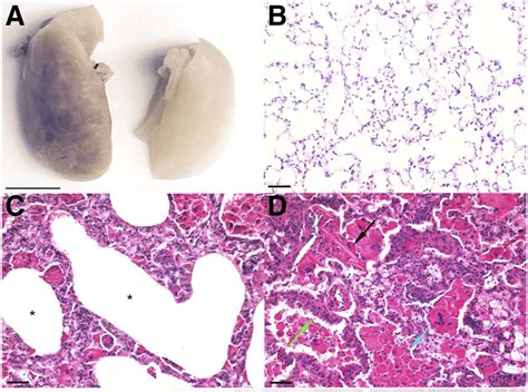 Mouse Lung Histology