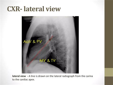 Assessment Of Prosthetic Valve Function Pptx
