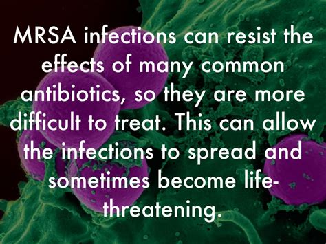 Staphylococcus Aureus Mrsa By Monet Chisholm