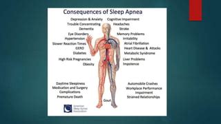 Obstructive Sleep Apnea OSA And Obesity Hypoventilation Syndrome OHS PPTX