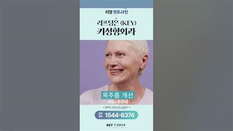 7일만의 변화 이중턱이 고민이라면 🎉 이중턱근육묶기와 탄성실 이중턱리프팅의 효과 이중턱리프팅 이중턱근육묶기 이중턱지방흡입 대구이중턱리프팅 Shorts