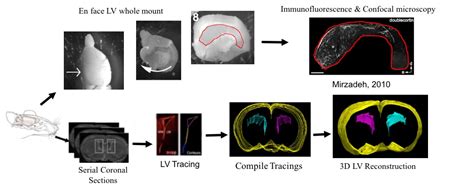 Brain Development In Hydrocephalus Conover Laboratory