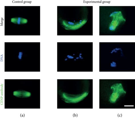 Effects Of The Cenp C Antibody On Spindle Assembly And Chromosome Download Scientific Diagram
