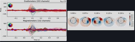 Python Mne 源定位和逆问题03：使用mne、dspm、sloreta和eloreta进行源定位 荔枝树
