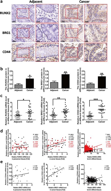 Runx2 Positively Correlates With Brg1 And Cd44 In Cancer Tissues A