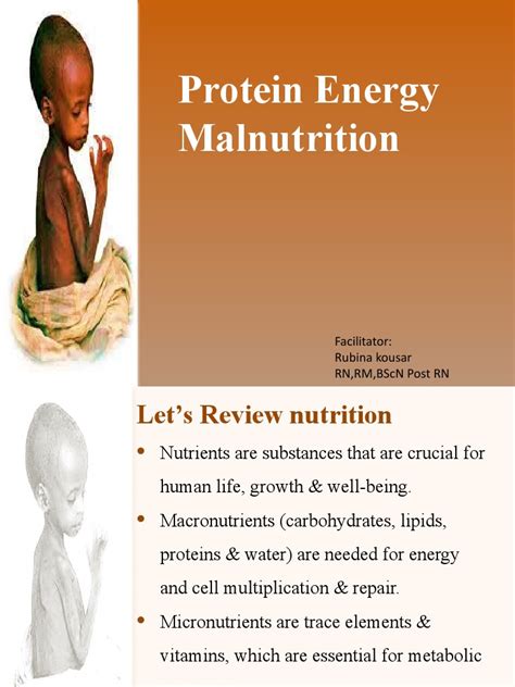 Protein Energy Malnutrition Guide Pdf Malnutrition Nutrients