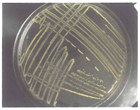 Staphylococcus Aureus Morphology Culture Virulence And Diseases