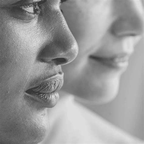 How Many Syringes For Lip Filler Viva Skin Clinics Blog