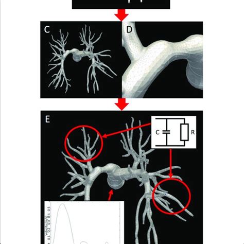 Pipeline For The Generation Of Patient Specific Models And