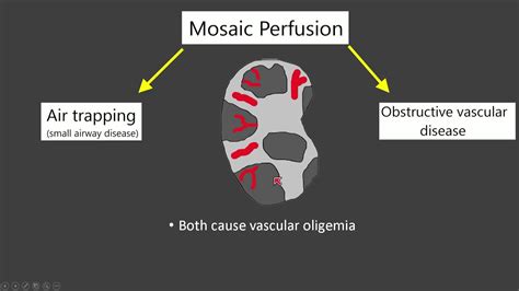 Mosaic Attenuation Youtube