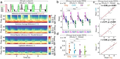 Eeg Sleep Study Opecbuddy