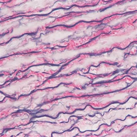 Verhoeff Pathotec Ag