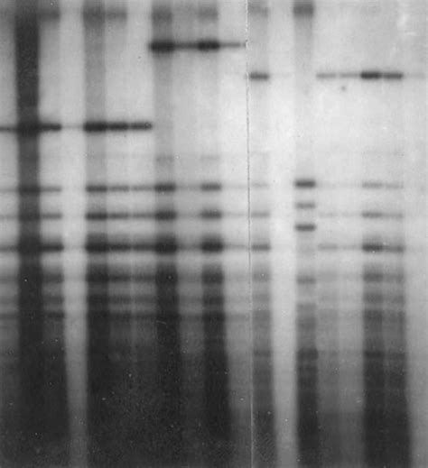 Multilocus Fingerprinting Of Dna Samples Isolated From The Tissues And Download Scientific