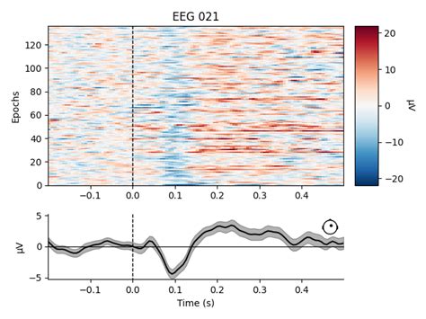 overview of meg eeg analysis with mne python — mne 1 3 1 documentation