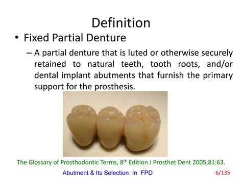 Abutment And Its Selection In Fixed Partial Denture Pptx