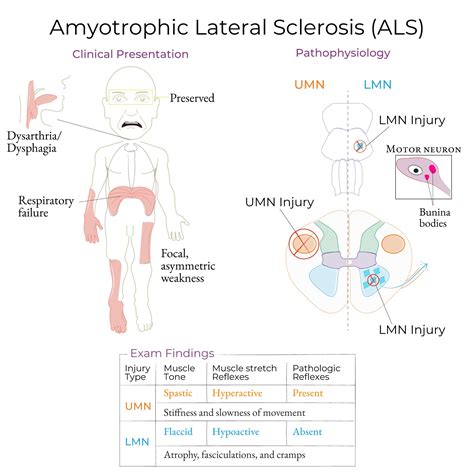 Clinical Pathology Glossary Amyotrophic Lateral Sclerosis Als Ditki Medical And Biological