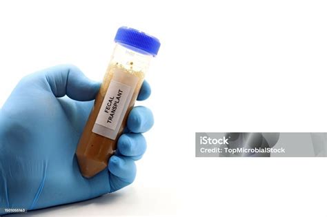 대변 이식 또는 대변 이식 클로스트리디움 박테리아 감염과 같은 지속적인 소화기 질환을 치료하기 위한 분변 미생물군이 있는 실험실 튜브 배설물에 대한 스톡 사진 및 기타