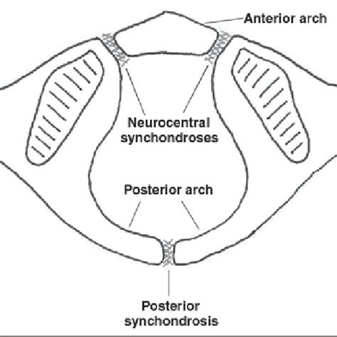 Pdf Ossification Patterns Of The Atlas Vertebra