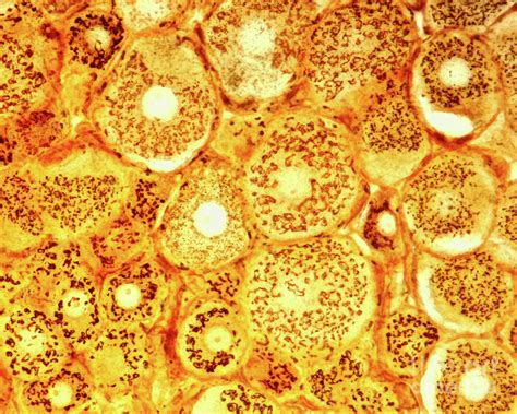 Dorsal Root Ganglion Neurons 5 Photograph By Jose Calvo Science Photo Library Pixels Merch