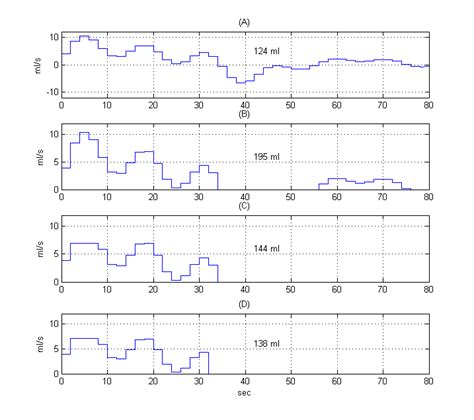 Computed Injection Protocols Using The Fourier Deconvolution Method