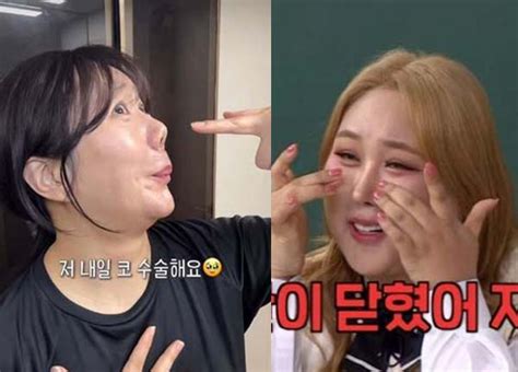 유독 ‘재수술 많은 코 성형 이유는 바로… 헬스조선