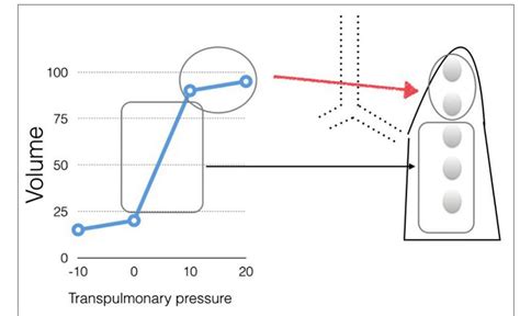 Transpulmonary Pressure