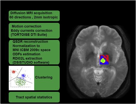 Processing Pipeline Flow Chart That Illustrates The Steps Of The Dmri Download Scientific