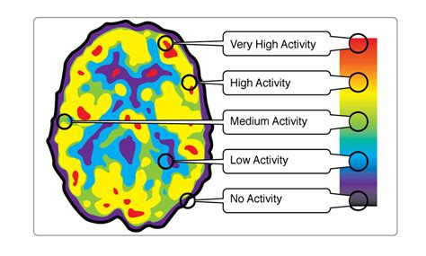 PET Scan G101 Team 1 Cognitive