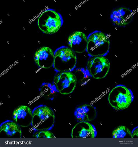 Dendritic Cells Labeled Green Fluorescent Dye Stock Photo