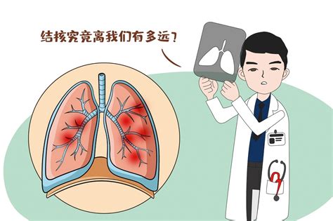 不仅长在肺上 还爱在人体里躲猫猫 关于结核 那些你不知道的事 荆楚网 湖北日报网
