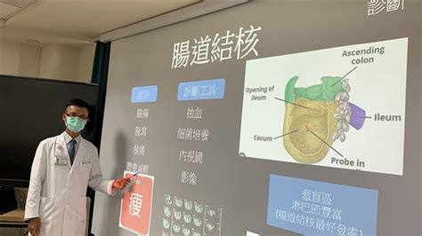 60歲男半年暴瘦10KG 3度腸阻塞送急診以為罹癌 醫1細菌感染難診斷 祝你健康 三立新聞網 HEALTH SETN
