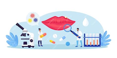 Herpes Simplex Virus Op Menselijke Lippen Dermatologische Ziekte Met