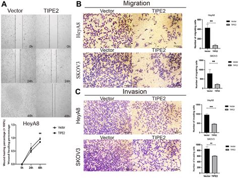 Tipe2 Acts As A Tumor Suppressor And Correlates With Tumor Microenvironment Immunity In