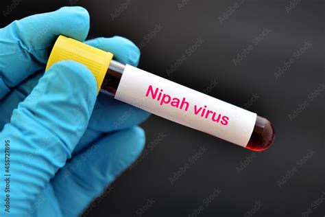 Blood Sample Tube Positive With Nipah Virus Test Stock Photo Adobe Stock