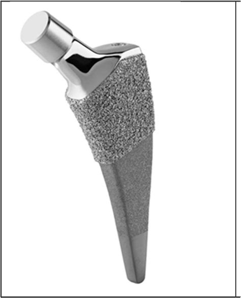 Photograph Showing The Short Modular Femoral Stem Smf™ Smith And Download Scientific Diagram
