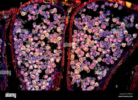 Male Cone Pinus Sp Showing Pollen Photomicrograph X100 Darkfield Cross Section Pinophyta