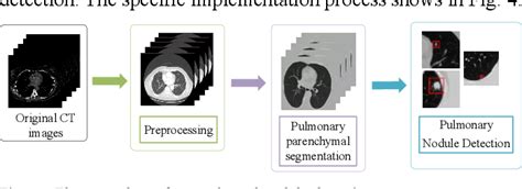Figure 4 From Pulmonary Nodules Detection Via 3d Multi Scale Dual Path Network Semantic Scholar