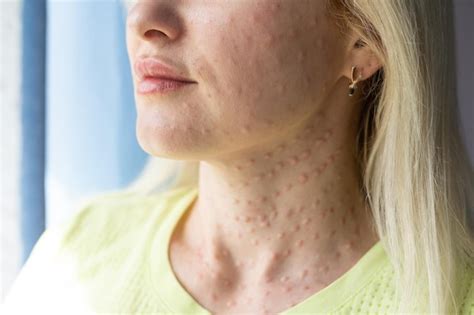 Premium Photo Real Skin Biorevitalization On White Background Traces