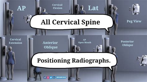 Positioning Of Cervical Spine X Rays By Anis Qureshi Youtube