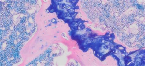 Vitroview™ Differential Quik Stain Kit