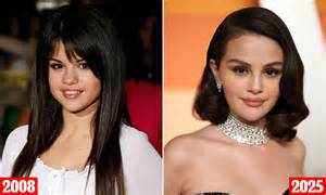 Plastic Surgeons Weigh In On Selena Gomezs Look After Newlywed