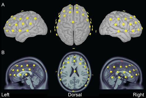 Neuroimaging Field Methods Using Functional Near Infrared Spectroscopy