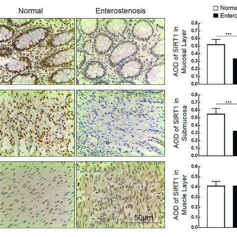 The Expression Characteristics Of Transforming Growth Factor β1 Download Scientific Diagram