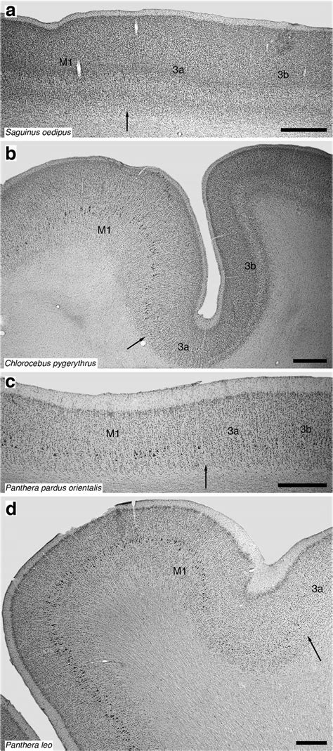 Low Power Photomicrographs Of Sagittal Nissl Stained Sections Through
